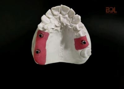 China CNC Precision Machining Custom Abutment Dental Implant For Missing One Or More Teeth for sale