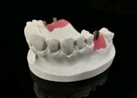 China CNC Precision Machining Custom Abutment Dental Implant For Missing One Or More Teeth for sale