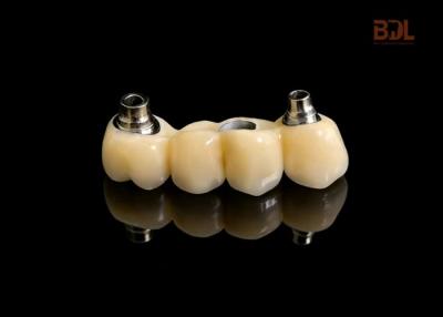 China 3 Days Turnaround Time Dental Implant Bar Supports Overdentures And Fixed Prostheses for sale