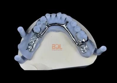 China 3D Printed Removable Partial Denture With Highly Polished Surface For Exquisite Appearance for sale
