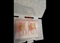 China Hypoallergenic Biocompatible Flexible Partial Dentures With High Comfort Due To Flexibility for sale