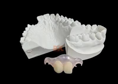 China Hypoallergenic Biocompatible Flexible Partial Dentures With High Comfort Due To Flexibility for sale