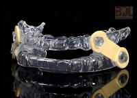 China Removable Orthodontic Appliance For Easy To Clean Convenient Removal With Worry Free Correction for sale