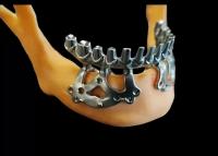 China Dental Implant Bar Grade 5 Titanium Alloy Integrated Precision Machining 9mm 13mm 17mm for sale
