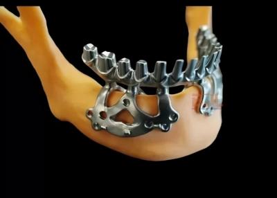 China Dental Implant Bar Grade 5 Titanium Alloy Integrated Precision Machining 9mm 13mm 17mm for sale