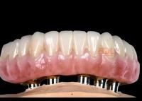 China Dental Implant Bar Grade 5 Titanium Alloy Integrated Precision Machining 9mm 13mm 17mm for sale