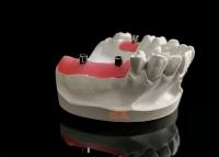 China Adaptable Bone Density TypeⅡ-Ⅳ Bone Dental Implant Bar Component For Dental Restoration for sale