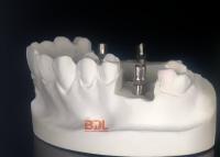 China CNC Precision Machining Dental Implant Bar Missing One Or More Teeth Ensuring Dental Care for sale