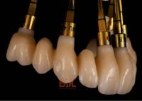China Adaptable Bone Density TypeⅡ-Ⅳ Bone Implant Composed Of Pure Titanium Grade 5 for sale