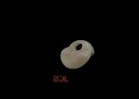 China Minimally Invasive Immediate Implantation Dental Implant Bar For Optimal Adaptability for sale