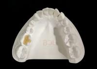 China Emax Dental Restorations With Lithium Disilicate Ceramic For High Strength Biocompatibility for sale