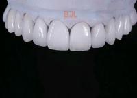 China Emax Dental Milling System Offering Sintering Temperature Approximately 850C-950C for sale