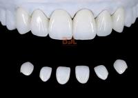 China Emax Dental Milling System Offering Sintering Temperature Approximately 850C-950C for sale