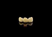 China Custom Made To Fit Individual Mouth Shape Translucency All Ceramic Crown Non Toxic for sale