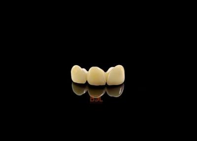 China Custom Made To Fit Individual Mouth Shape Translucency All Ceramic Crown Non Toxic for sale