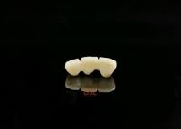 China Custom Made To Fit Individual Mouth Shape Translucency All Ceramic Crown Non Toxic for sale