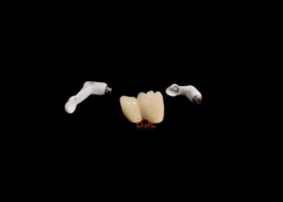China Dental Implant Bar offering personalized dental restoration with lifelike aesthetics and durable stable occlusion design for sale