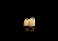 China Dental Implant Bar offering personalized dental restoration with lifelike aesthetics and durable stable occlusion design for sale