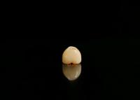 China Digital Dental Implant Bar with Customized Scan Body All Ceramic Crown and Wax Pattern for Full Process Implant Restoration Control for sale
