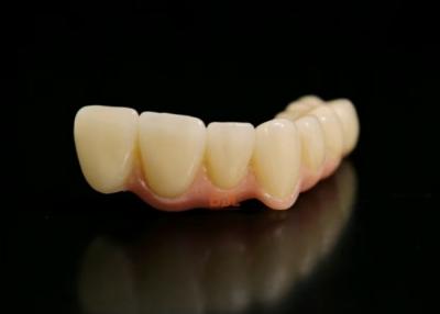 China Ceramic Dentures designed for anterior and posterior restorations providing fracture resistance and realistic appearance for sale