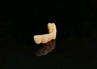 China Ceramic Dentures designed for anterior and posterior restorations providing fracture resistance and realistic appearance for sale