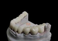 China Ceramic Dentures High Strength and Durable Customized All Ceramic Dental Bridge with Anatomical Accuracy and Custom Shade Matching for sale