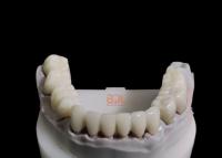 China Ceramic Dentures High Strength and Durable Customized All Ceramic Dental Bridge with Anatomical Accuracy and Custom Shade Matching for sale