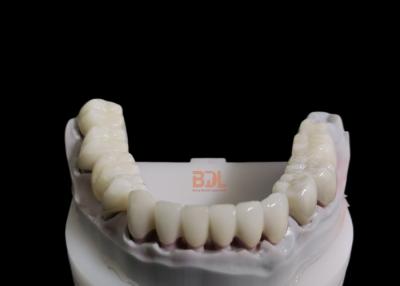 China Ceramic Dentures High Strength and Durable Customized All Ceramic Dental Bridge with Anatomical Accuracy and Custom Shade Matching for sale