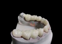 China Ceramic Dentures High Strength and Durable Customized All Ceramic Dental Bridge with Anatomical Accuracy and Custom Shade Matching for sale