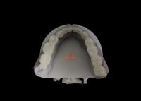 China Ceramic Dentures High Strength and Durable Customized All Ceramic Dental Bridge with Anatomical Accuracy and Custom Shade Matching for sale