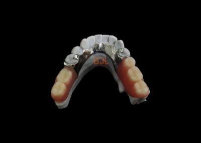 China Metal Partial Dentures made from medical grade cobalt chromium alloy framework ensuring long lasting performance and wearer comfort for sale
