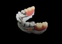China Metal Partial Dentures made from medical grade cobalt chromium alloy framework ensuring long lasting performance and wearer comfort for sale