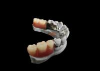 China Metal Partial Dentures made from medical grade cobalt chromium alloy framework ensuring long lasting performance and wearer comfort for sale