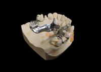 China High Strength Cobalt Chromium Metal Partial Dentures with Cast Clasps Lingual Bar Connector and Mesh Reinforcement for Mandibular Dental Restoration for sale