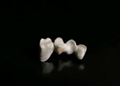 China Custom Made Porcelain Fused To Metal Partial Dentures with Titanium Metal Framework and Anatomically Contoured All Ceramic Bridge for sale