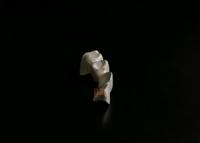 China Custom Made Porcelain Fused To Metal Partial Dentures with Titanium Metal Framework and Anatomically Contoured All Ceramic Bridge for sale