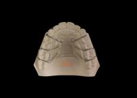 China Custom-fit Orthodontic Retainers with Hypoallergenic Materials and Removable Design for Comfortable Wear for sale
