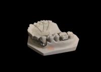 China Custom-fit Orthodontic Retainers with Hypoallergenic Materials and Removable Design for Comfortable Wear for sale
