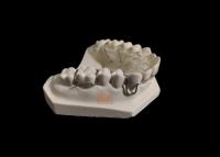 China Custom-fit Orthodontic Retainers with Hypoallergenic Materials and Removable Design for Comfortable Wear for sale