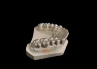 China Custom-made Orthodontic Retainers with Medical-grade Acrylic for Gentle Continuous Force and Superior Comfort for sale
