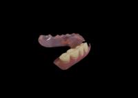 China No Metal Showing Hypoallergenic Flexible Partial Denture with 3-Day Turnaround for Comfortable Dental Restoration for sale