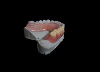 China No Metal Showing Hypoallergenic Flexible Partial Denture with 3-Day Turnaround for Comfortable Dental Restoration for sale