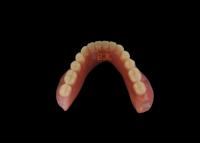 China Durable Comfortable Complete Acrylic Denture Custom Molded Precision Fit Suitable for Tooth Replacement Applications for sale