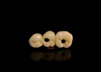 China Durable Dental Implant Support Bar Manufactured from High Strength Materials to Ensure Long Term Stability and Performance for sale