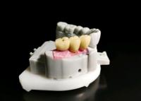 China Durable Dental Implant Support Bar Manufactured from High Strength Materials to Ensure Long Term Stability and Performance for sale