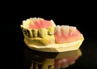 China Comfort Fit Durable Complete Acrylic Denture Precision Engineered Material Lightweight Suitable Dental Solutions for sale