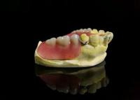 China Comfort Fit Durable Complete Acrylic Denture Precision Engineered Material Lightweight Suitable Dental Solutions for sale
