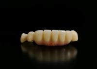 China Highly Compatible Ceramic Dental Prosthetics Providing Optimal Strength and Natural Look for Effective Dental Treatments for sale