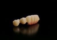 China Highly Compatible Ceramic Dental Prosthetics Providing Optimal Strength and Natural Look for Effective Dental Treatments for sale