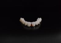 China Customizable Ceramic Dental Prostheses Tailored to Meet Specific Dental Restoration Requirements and Patient Preferences for sale